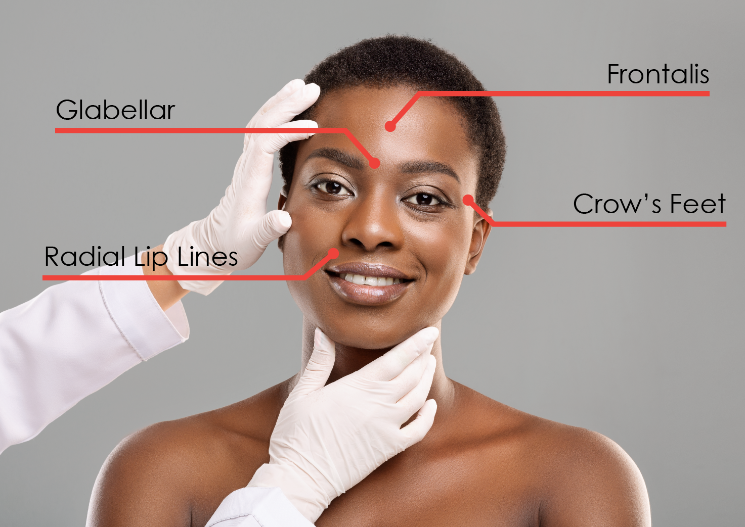 Botox Uses | Aventura, FL, Dentist Near You