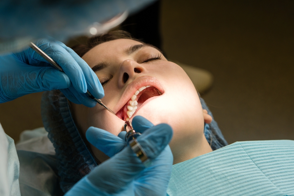 Wisdom Teeth Removal | Pembroke Pines, FL, Dentist Near Me
